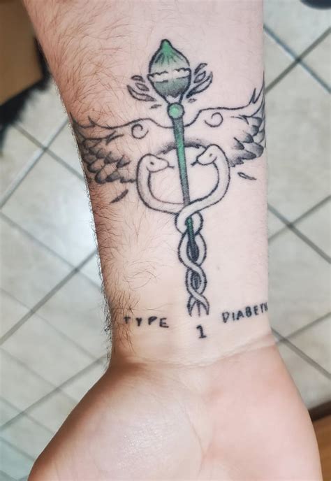 Dexcom Transmitter Issues R Type1diabetes