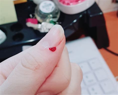 블라인드 블라블라 손가락 피 인증합니다