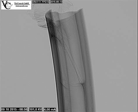 Composite X Ray At Christopher Zavala Blog