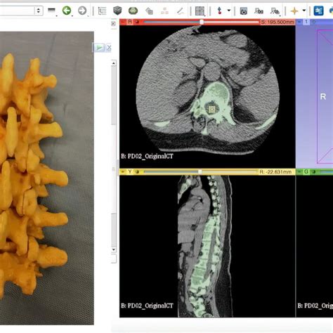 3d Printable Convert Your Ct Mri Scans To 3d Printable File By Asem
