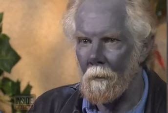 Blue Man Dies Paul Karason Dead At 62 Had Blue Skin Photo The