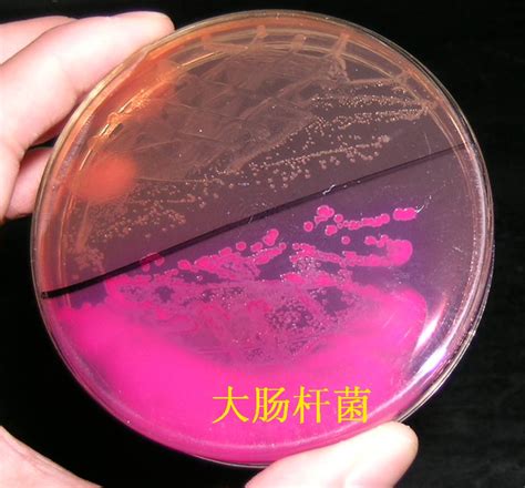 哪位大神有显微镜下的沙门氏菌大肠杆菌和支原体衣原体的图片啊？麻烦大家帮帮忙 天下鸽问