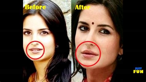 Bollywood Actress Who Looks Horrible After Plastic Su