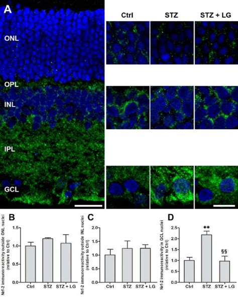 A Nuclear Factor Erythroid 2 Related Factor 2 Nrf2 Immunostaining