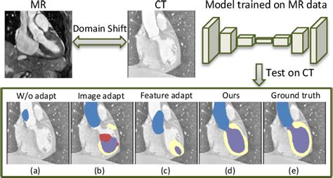 Figure 1 From Synergistic Image And Feature Adaptation Towards Cross Modality Domain Adaptation