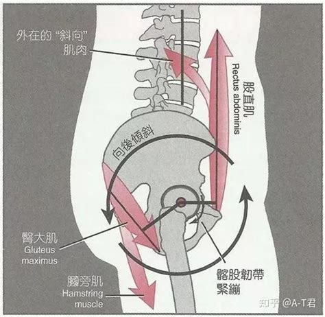 骨盆不正到底对身体影响有多大？ 知乎