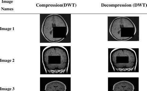 Compression And Decompression For Nroi Region By Using Hybrid Algorithm Download Scientific