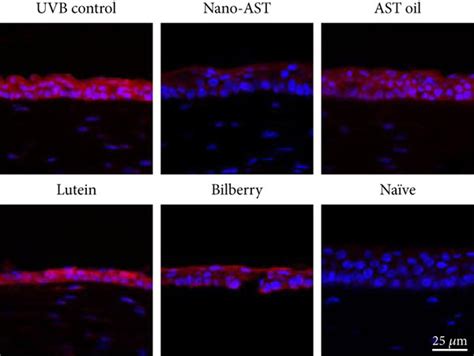 Assessment Of Reactive Oxygen Species Ros Levels By Dihydroethidium Download Scientific