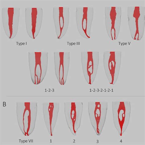 Virtual Models Of The Roots A Root Canal Configurations Found In