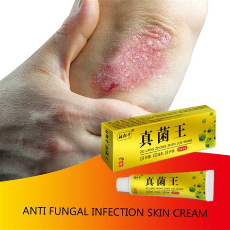 15g Anti Itch Dermatitis Inflammation Rashes Cream Eczema Ointment