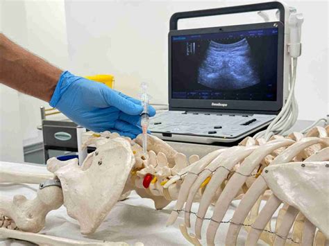 Facet Joint Syndrome Diagnosis Treatment