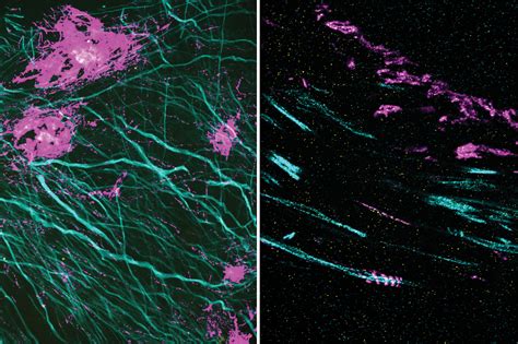 Microscopy Technique Reveals Hidden Nanostructures In Cells And Tissues Mit News