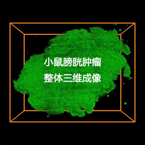 武汉光量科技有限公司 光透明肿瘤成像