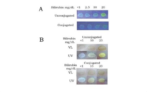 The Appearance Of Control And Elevated Bilirubin Serums Under Visible Download Scientific