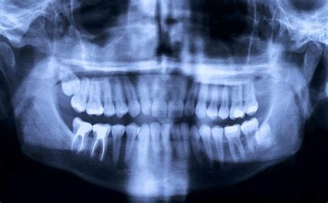 Хатагтай дент шүдний эмнэлэг