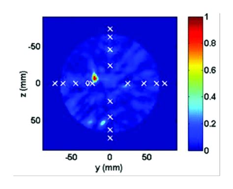 A Breast Cancer Detection System Using An Antenna Array With Radome Download Scientific