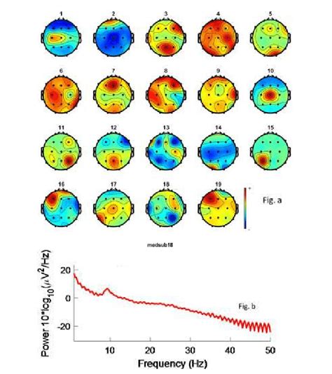 A Independent Components Of EEG Data B PSD Of Component 11 Download Scientific Diagram