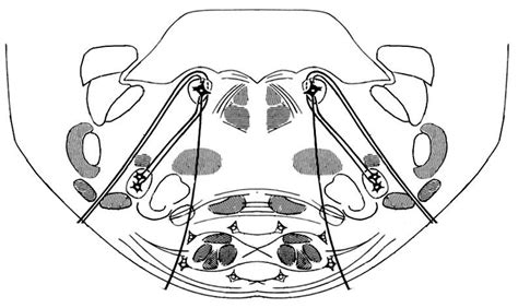 Pontomedullary Junction Cross Section Diagram Quizlet