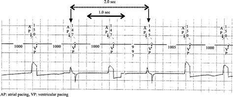 Inhibition Of The Oversensing Of Cardiac Pacemakers In Chest Ct