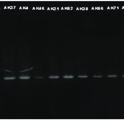 Pcr Amplified Band Of 16s Rdna Gene Using Primers 41f And 1488r From