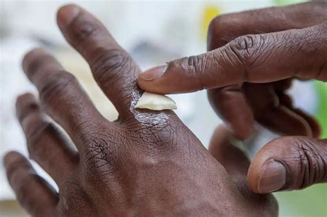 How To Get Super Glue Off Skin 6 Easy Steps Cleanipedia UK