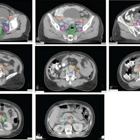 A U2013h Definition Of Lymph Node Groups Different Groups Were Download Scientific Diagram
