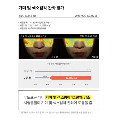 메디톨드 헠크림 내돈내산 후기 효과 부작용 사용법 꿀팁매거진
