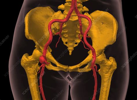 Femoral Artery