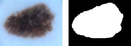 Augmentor Image Augmentation Library In Python For Machine Learning