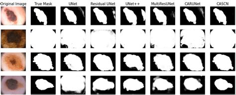 Visual Comparison Of Challenging Cases In The Ph2 Dataset Download