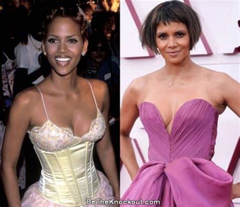 Halle Berry Plastic Surgery Comparison Photos