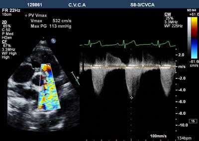 Echo Midterm Flashcards Quizlet