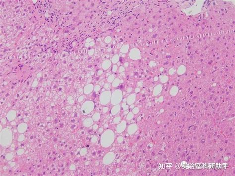 切片学习 常规病理组织切片及诊断要点 知乎