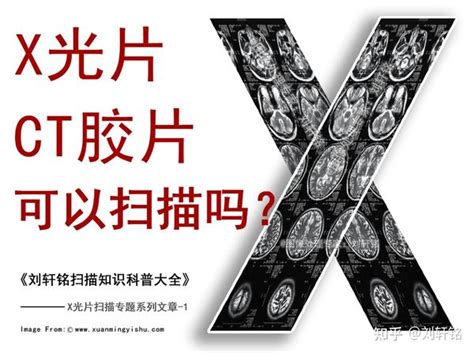 X光片和ct胶片可以扫描吗？ 知乎