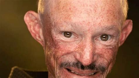 Muere Darren Kent De ‘juego De Tronos Tikitakas