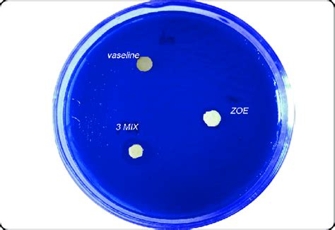 Streptococcus Salivarius Agar Engineered Probiotic Overcomes Pathogen