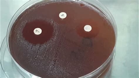 Antibiotic Sensitivity Testing Result Of Streptococcus Agalactiae Youtube
