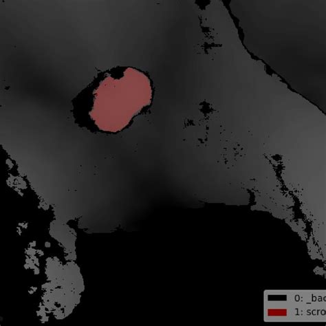 Image Segmentation Visualisation An Example Of A True Scrotum