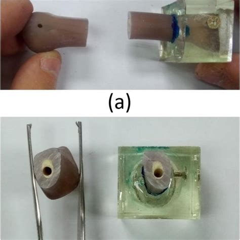 Artificial Metacarpal Bones With Transverse Shaft Fracture Subjected To Download Scientific