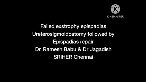 Epispadias Repair Applications Of The Modified Cantwellransley