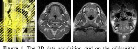 Figure 1 From Are Static Mri Measurements Representative Of Dynamic Speech Results From A