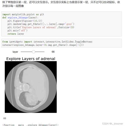 Nii数据的各种处理详解acdc数据集nii文件在pytorch中需要处理吗 Csdn博客 Nii数据的各种处理详解acdc数据集nii文件在pytorch中需要处理吗 Csdn博客