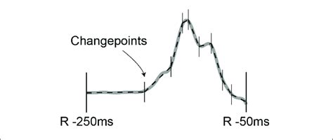 Averaged P Wave Reconstruction By Linear Fits Using Matlabs