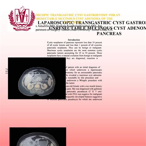 Laparoscopic Transgastric Cyst Gastrostomy For An Unresectable Mucinous Cyst Adenoma Of The