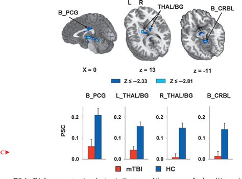 Figure 1 From An Fmri Study Of Auditory Orienting And Inhibition Of