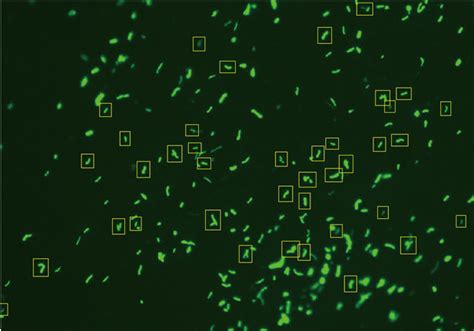 Scanpro 3 200 Mycobacterium Tuberculosis Microscopy Scanning System