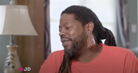Dr Pimple Popper Removes Jds Smelly Saggy Earlobe Keloid After 25 Years