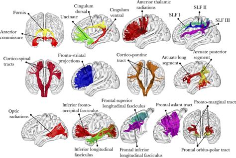 Overview Of White Matter Tracts Reprinted From Thiebaut De Schotten Et