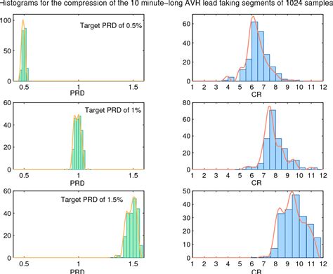 Figure 15 From A Low Computational Complexity Algorithm For Ecg Signal