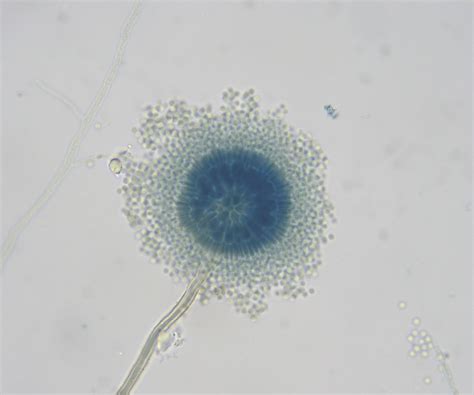 Aspergillus Ochraceus Microscopic View Of Aspergillus Orch Flickr
